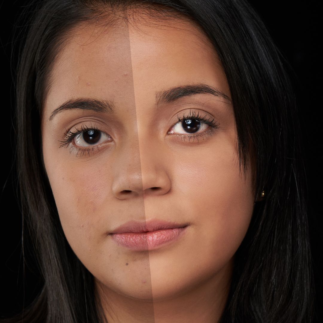 Tan & Dull Face Solution – Kiwi & Coco