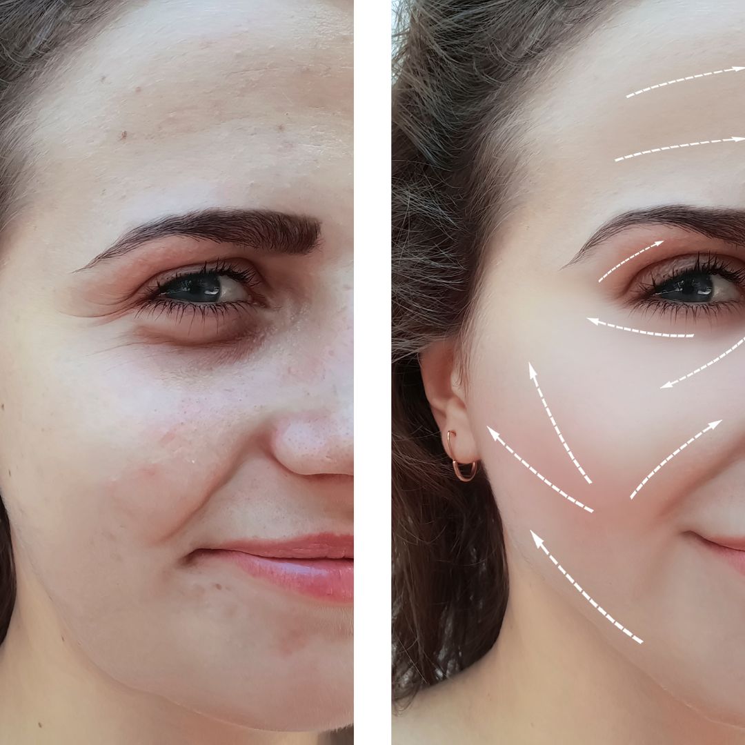 Intense Face Care Therapy For Dull & Spotted Face – Kiwi & Coco